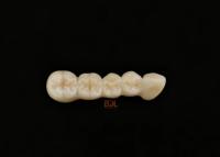 China Durable Ceramic Dental Prosthetics made from ceramics ensuring excellent strength natural appearance and long term for sale