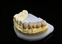 China Durable Ceramic Dental Prosthetics made from ceramics ensuring excellent strength natural appearance and long term for sale