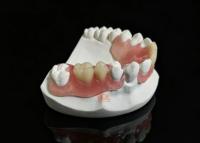 China Natural Appearance Flexible Partial Denture Appliance combining comfort durability and flexible design for dental applications for sale