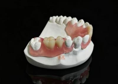 China Natural Appearance Flexible Partial Denture Appliance combining comfort durability and flexible design for dental applications for sale