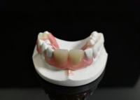 China Natural Appearance Flexible Partial Denture Appliance combining comfort durability and flexible design for dental applications for sale