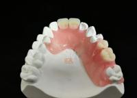 China Natural Appearance Flexible Partial Denture Appliance combining comfort durability and flexible design for dental applications for sale