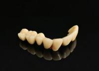 China Porcelain Fused To Metal Multi Crown Dental Bridge With Burr Free Inner Coping And Warm Yellow Porcelain Veneer For Long Term Stability for sale