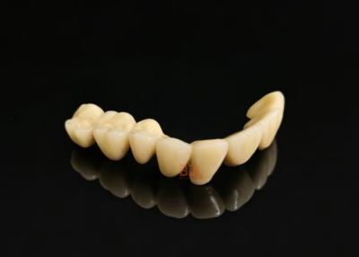 China Porcelain Fused To Metal Multi Crown Dental Bridge With Burr Free Inner Coping And Warm Yellow Porcelain Veneer For Long Term Stability for sale