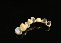 China Porcelain Fused To Metal Multi Crown Dental Bridge With Burr Free Inner Coping And Warm Yellow Porcelain Veneer For Long Term Stability for sale