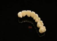 China Porcelain Fused To Metal Multi Crown Dental Bridge With Burr Free Inner Coping And Warm Yellow Porcelain Veneer For Long Term Stability for sale