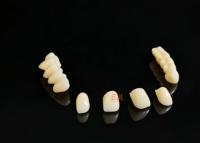 China Long Lasting Ceramic Dental Prosthesis Engineered to Meet the Demands of Dental Professionals and Laboratories Worldwide for sale