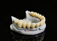 China Long Lasting Ceramic Dental Prosthesis Engineered to Meet the Demands of Dental Professionals and Laboratories Worldwide for sale