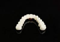 China Durable Porcelain Fused To Metal Crown Dental Restoration Solution Ideal For Long Lasting Strength And Natural Appearance for sale