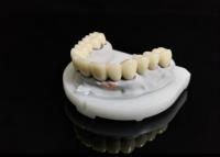 China Durable Porcelain Fused To Metal Crown Dental Restoration Solution Ideal For Long Lasting Strength And Natural Appearance for sale