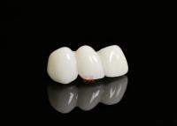 China Lightweight Ceramic Dental Prosthetics engineered for optimal comfort outstanding functionality and seamless integration for sale