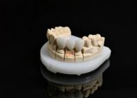 China Lightweight Ceramic Dental Prosthetics engineered for optimal comfort outstanding functionality and seamless integration for sale