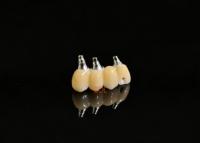 China Corrosion Resistant Dental Implant Support Bar Featuring Precision Machining and Superior Strength for Dental Solutions for sale