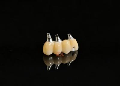 China Corrosion Resistant Dental Implant Support Bar Featuring Precision Machining and Superior Strength for Dental Solutions for sale