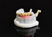 China Corrosion Resistant Dental Implant Support Bar Featuring Precision Machining and Superior Strength for Dental Solutions for sale
