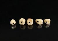 China Medical Grade Dental Implant Support Bar Designed to Provide Stable Foundation for Implant Retained Dentures and Bridges for sale