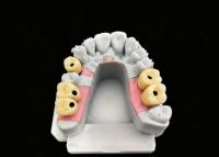 China Medical Grade Dental Implant Support Bar Designed to Provide Stable Foundation for Implant Retained Dentures and Bridges for sale