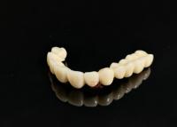 China Custom Porcelain Fused To Metal Dental Crowns Strong Metal Base With Aesthetic Porcelain Coating For Superior Durability for sale