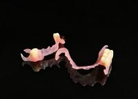 China Durable Flexible Removable Partial Dentures Customized Comfortable Lightweight Design Suitable Dental Applications for sale