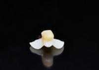 China Lightweight Ceramic Dental Prosthesis Offering Enhanced Comfort and Natural Appearance for Effective Dental Rehabilitation for sale