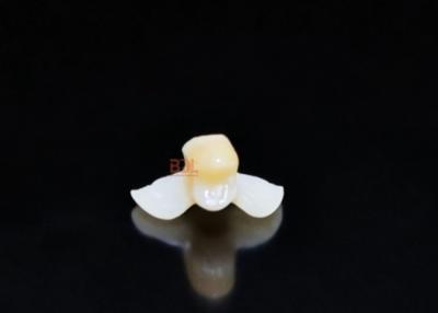 China Lightweight Ceramic Dental Prosthesis Offering Enhanced Comfort and Natural Appearance for Effective Dental Rehabilitation for sale