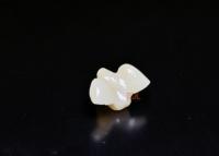 China Lightweight Ceramic Dental Prosthesis Offering Enhanced Comfort and Natural Appearance for Effective Dental Rehabilitation for sale