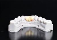 China Lightweight Ceramic Dental Prosthesis Offering Enhanced Comfort and Natural Appearance for Effective Dental Rehabilitation for sale