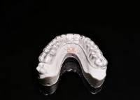 China Adjustable Occlusal Splint Designed to Relieve Jaw Muscle Fatigue and Prevent Damage from Bruxism During Sleep for sale