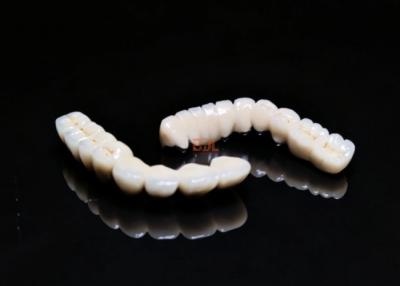 China Custom Porcelain Fused To Metal crowns and bridges designed for dental restoration with optimal mechanical properties for sale