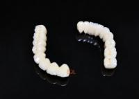 China Custom Porcelain Fused To Metal crowns and bridges designed for dental restoration with optimal mechanical properties for sale