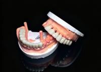 China Custom Porcelain Fused To Metal crowns and bridges designed for dental restoration with optimal mechanical properties for sale