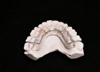 China Customizable Dental Retention Device Offering Precise Fit and Enhanced Retention Capabilities for Post Orthodontic Care for sale