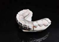 China Customizable Dental Retention Device Offering Precise Fit and Enhanced Retention Capabilities for Post Orthodontic Care for sale