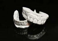 China Removable Comfortable Dental Retention Appliance Designed for Easy Cleaning and Consistent Orthodontic Retention Results for sale