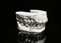 China Removable Comfortable Dental Retention Appliance Designed for Easy Cleaning and Consistent Orthodontic Retention Results for sale