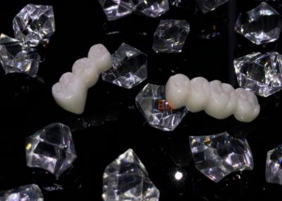 China Custom Fit Ceramic Dental Prosthesis Engineered to Deliver Durable and Natural Looking Solutions for Dental Laboratories for sale