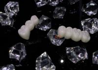 China Custom Fit Ceramic Dental Prosthesis Engineered to Deliver Durable and Natural Looking Solutions for Dental Laboratories for sale