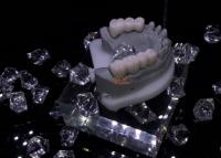China Custom Fit Ceramic Dental Prosthesis Engineered to Deliver Durable and Natural Looking Solutions for Dental Laboratories for sale