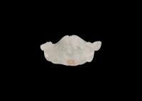 China Precision Advanced Dental Implant Solutions Offering Custom Fit Enhanced Biocompatibility and Performance for Surgeons for sale