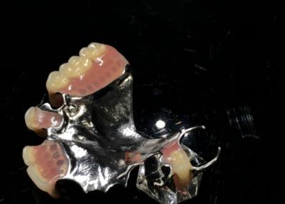 China Stainless Durable Metal Framework Partial Dentures designed to resist corrosion and provide dental restoration solutions for sale