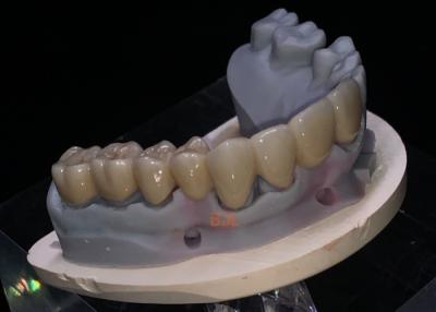 China Custom fit Ceramic Dental Prosthetics featuring excellent strength natural look and performance in restorative dental applications for sale