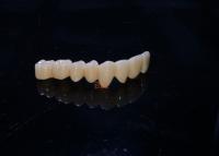 China Custom fit Ceramic Dental Prosthetics featuring excellent strength natural look and performance in restorative dental applications for sale