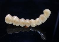 China Custom fit Ceramic Dental Prosthetics featuring excellent strength natural look and performance in restorative dental applications for sale