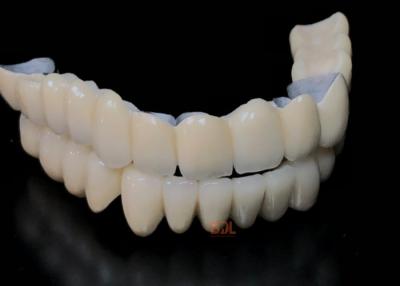 China Custom Designed Porcelain Fused To Metal Crown Combining Strength And Esthetics For Long Term Dental Restoration Success for sale