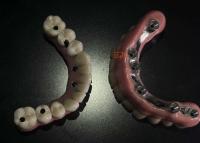 China High Strength Corrosion Resistant Dental Implant Support Bar Providing Support and Stability for Fixed Dental Prostheses for sale
