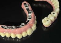 China High Strength Corrosion Resistant Dental Implant Support Bar Providing Support and Stability for Fixed Dental Prostheses for sale