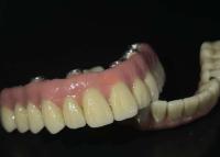 China High Strength Corrosion Resistant Dental Implant Support Bar Providing Support and Stability for Fixed Dental Prostheses for sale