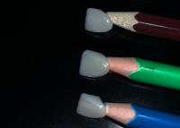 China Versatile Emax Ceramic Veneer Suitable for Multiple Dental Restoration Techniques Including Crowns Bridges and Laminates for sale