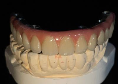 China Custom Fit Dental Implant Support Bar Made from Titanium Alloy Providing Support and Long Term Durability in Implant Dentistry for sale
