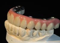 China Custom Fit Dental Implant Support Bar Made from Titanium Alloy Providing Support and Long Term Durability in Implant Dentistry for sale